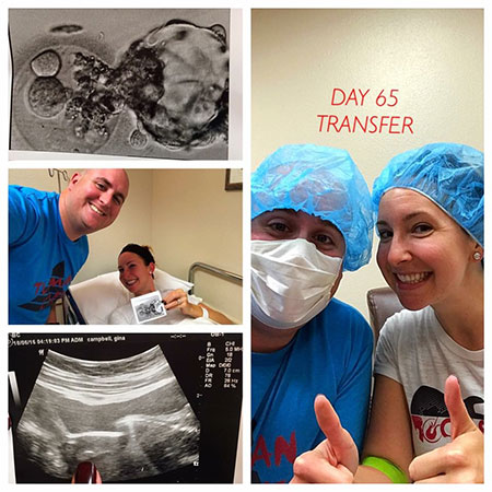 Single Embryo Transfer IVF Success Story – Las Vegas Fertility Center