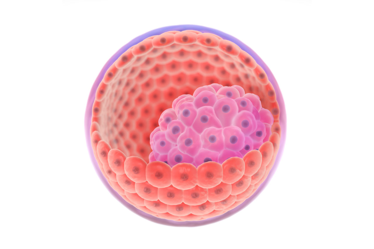 Fresh or Frozen Embryo Transfer - IVF - Las Vegas Infertility Center